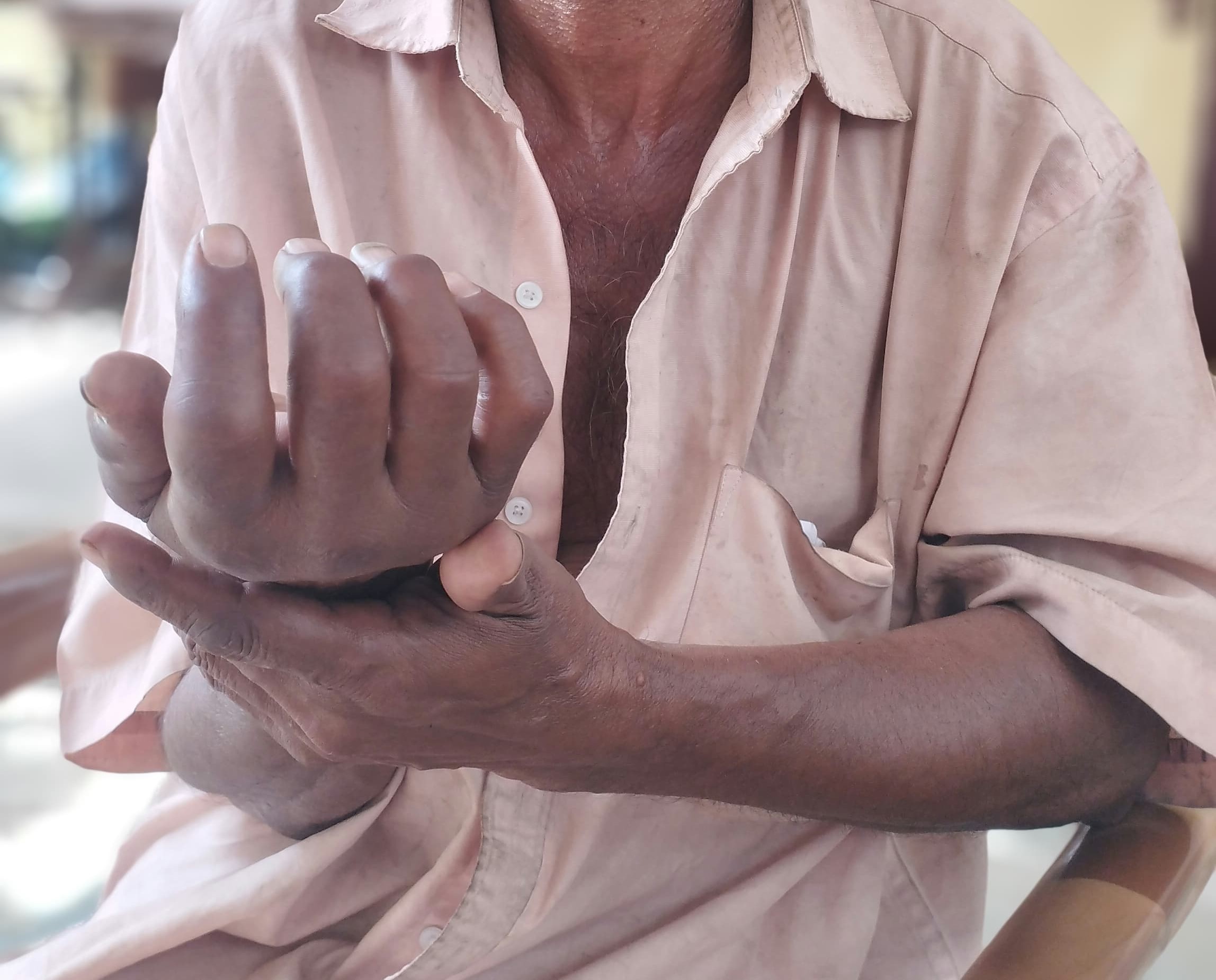 Medical support to sick & injured homeless man – Snehan